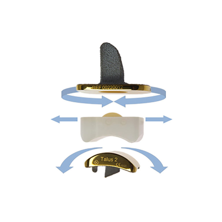Total Ankle Replacement - CliniLab