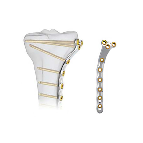 Proximal Tibia Plate - CliniLab