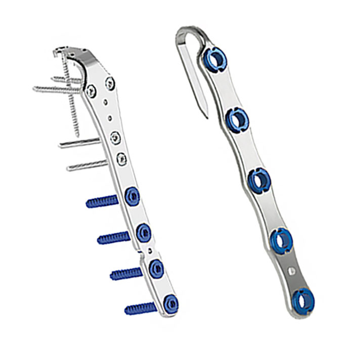 Olecranon & Hook Plates - CliniLab